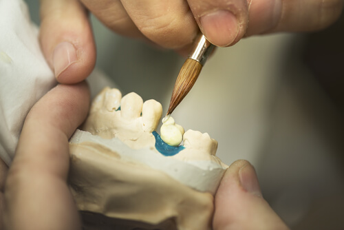 Prosthodontics procedures can be used to brighten up your smile